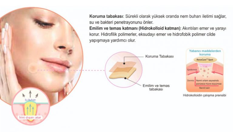 ÜRÜN HAKKINDA | RenoCare® SPOT